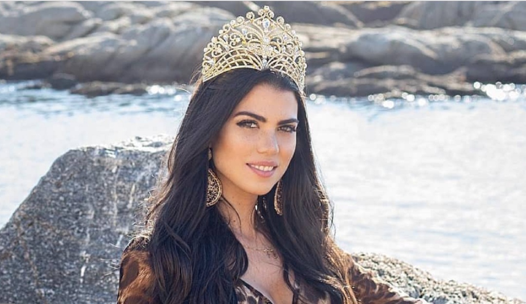Miss Chile y el trágico momento que vivió con su rostro quemado con ...